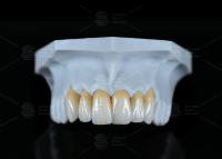 China High Translucency Full Contour Zirconia Bridge Chipping Resistance Natural Esthetics for sale
