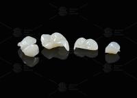 China Translucent Onlay Zirconia Inlay For Long Lasting Stain And Wear Resistance for sale