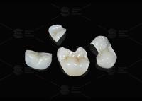 China Translucent Onlay Zirconia Inlay For Long Lasting Stain And Wear Resistance for sale