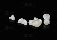 China Translucent Onlay Zirconia Inlay For Long Lasting Stain And Wear Resistance for sale
