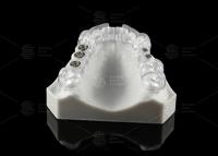 China Custom Made Transparent Dental Implant Solution Surgical Stent Ergonomic Design for sale
