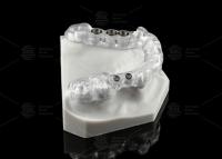China Custom Made Transparent Dental Implant Solution Surgical Stent Ergonomic Design for sale