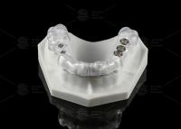 China Custom Made Transparent Dental Implant Solution Surgical Stent Ergonomic Design for sale