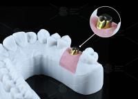 China Customized Titanium Base Corrosion Resistance Dental Implants And Solutions for sale