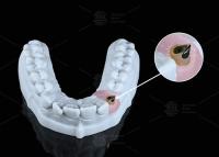 China Universal Angled Screw Channel Compatible With Cad / Cam Systems for sale