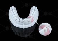 China White Custom Zirconia Abutment Natural Looking Aesthetics And Optimal Functionality for sale