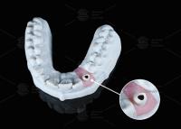 China White Custom Zirconia Abutment Natural Looking Aesthetics And Optimal Functionality for sale