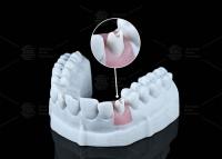 China White Custom Zirconia Abutment Natural Looking Aesthetics And Optimal Functionality for sale