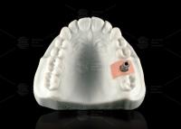 China Precision Titanium Digital Implant Scan Body Sandblasted Surface For Cad/Cam for sale