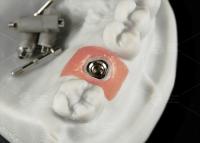 China Precision Titanium Digital Implant Scan Body Sandblasted Surface For Cad/Cam for sale