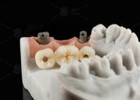 China Screw Retained Titanium Custom Abutment Porcelain Fused To Zirconia for sale