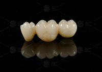 China Screw Retained Titanium Custom Abutment Porcelain Fused To Zirconia for sale