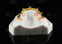 China Titanium Sandblasted Implant Locator Bar Silver Gold Dental Implant Locator Attachment for sale