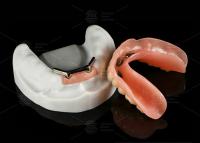 China Titanium Alloy Snap On Dolder Implant Bar Overdenture Polished For Natural Smile for sale