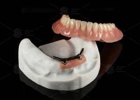 China Titanium Alloy Snap On Dolder Implant Bar Overdenture Polished For Natural Smile for sale