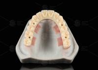 China Translucent Full Contour Zirconia Bridge Over Milled Implant Bar Customized Design for sale
