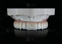 China Translucent Full Contour Zirconia Bridge Over Milled Implant Bar Customized Design for sale