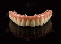 China Composite Pink Porcelain Crown A1 Shade All On 4 Hybrid Titanium Screw Retained for sale