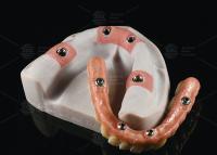 China Hybrid Pink Porcelain Implant Crown Malong Full Arch Implant Bridge Immediate Loading for sale