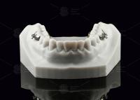 China Lingual Arch Biliteral Space Maintainer Stainless Steel Teeth Space Maintainers for sale