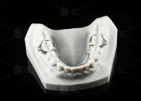 China Lingual Arch Biliteral Space Maintainer Stainless Steel Teeth Space Maintainers for sale