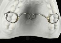 China ADL Transpalatal Arch Space Maintainer Removable Space Maintaining Arch for sale