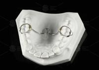 China ADL Transpalatal Arch Space Maintainer Removable Space Maintaining Arch for sale