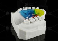 China Stainless Steel Acrylic Screw Expander Orthodontic Treatment Removable for sale