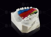 China Teeth Expansion And Distalization Palate Expander Orthodontic Expander for sale