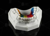 China Teeth Expansion And Distalization Palate Expander Orthodontic Expander for sale