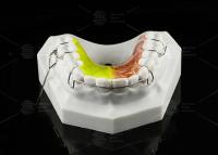China Orthodontic Fan Shaped Expander Provides Posterior Crossbite Free Section Expansion for sale