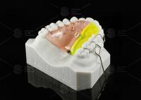 China Orthodontic Fan Shaped Expander Provides Posterior Crossbite Free Section Expansion for sale