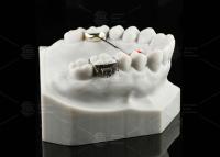 China Stainless Steel Orthodontic Nance Appliance Horseshoe Design Orthodontic Appliances for sale