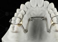 China Children And Adolescents Quad Helix Appliance Orthodontics Stainless Steel for sale