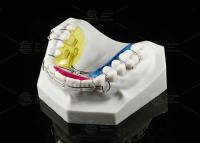 China Customizable Spring Hawley Retainer Removable Teeth Position Retention for sale