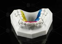 China Customizable Spring Hawley Retainer Removable Teeth Position Retention for sale