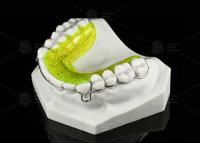 China Custom Fit BEGGS RETAINER Orthodontic For Teeth Alignment Easy To Clean for sale
