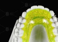China Custom Fit BEGGS RETAINER Orthodontic For Teeth Alignment Easy To Clean for sale