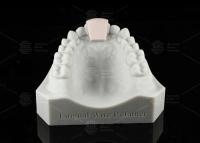 China Non Removable Lingual Wire Retainer Invisible Direct Bonded Lingual Retainer Wire for sale