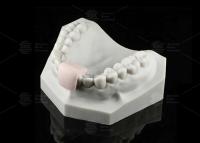 China Non Removable Lingual Wire Retainer Invisible Direct Bonded Lingual Retainer Wire for sale
