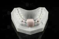 China Non Removable Lingual Wire Retainer Invisible Direct Bonded Lingual Retainer Wire for sale