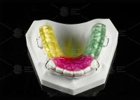 China Acrylic Twin Block Orthodontic Appliance For Correcting Malocclusion for sale