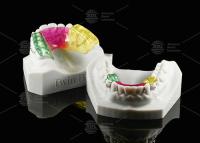 China Acrylic Twin Block Orthodontic Appliance For Correcting Malocclusion for sale
