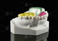China Acrylic Twin Block Orthodontic Appliance For Correcting Malocclusion for sale