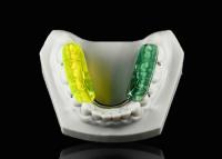 China Colorful Gelb Dental Splint Hard Acrylic Resin Occlusal Splint For Nighttime Teeth Grinding for sale
