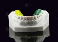 China Colorful Gelb Dental Splint Hard Acrylic Resin Occlusal Splint For Nighttime Teeth Grinding for sale