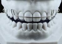 China Adjustable Synthetic Activator Appliance In Orthodontics Functional Appliance for sale