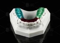 China Overbite Correction Protraction Facemask Teenagers Protraction Face Mask Orthodontics for sale