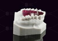 China Habbit Orthodontic Tongue Crib Appliance Customizable Dental Crib Appliance for sale