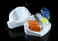 China Frankel Ⅲ Malocclusion Orthodontic Functional Appliance 13-16 Hours During Night for sale